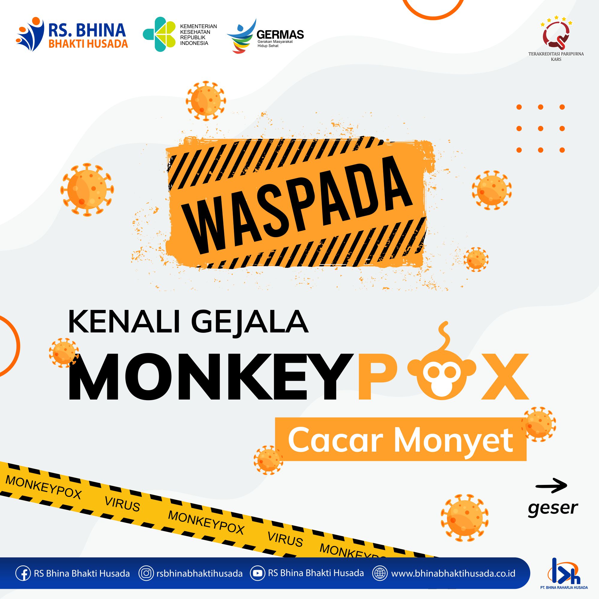 Kenali Gejala Monkey Pox (Cacar Monyet) – RS Bhina Bhakti Husada